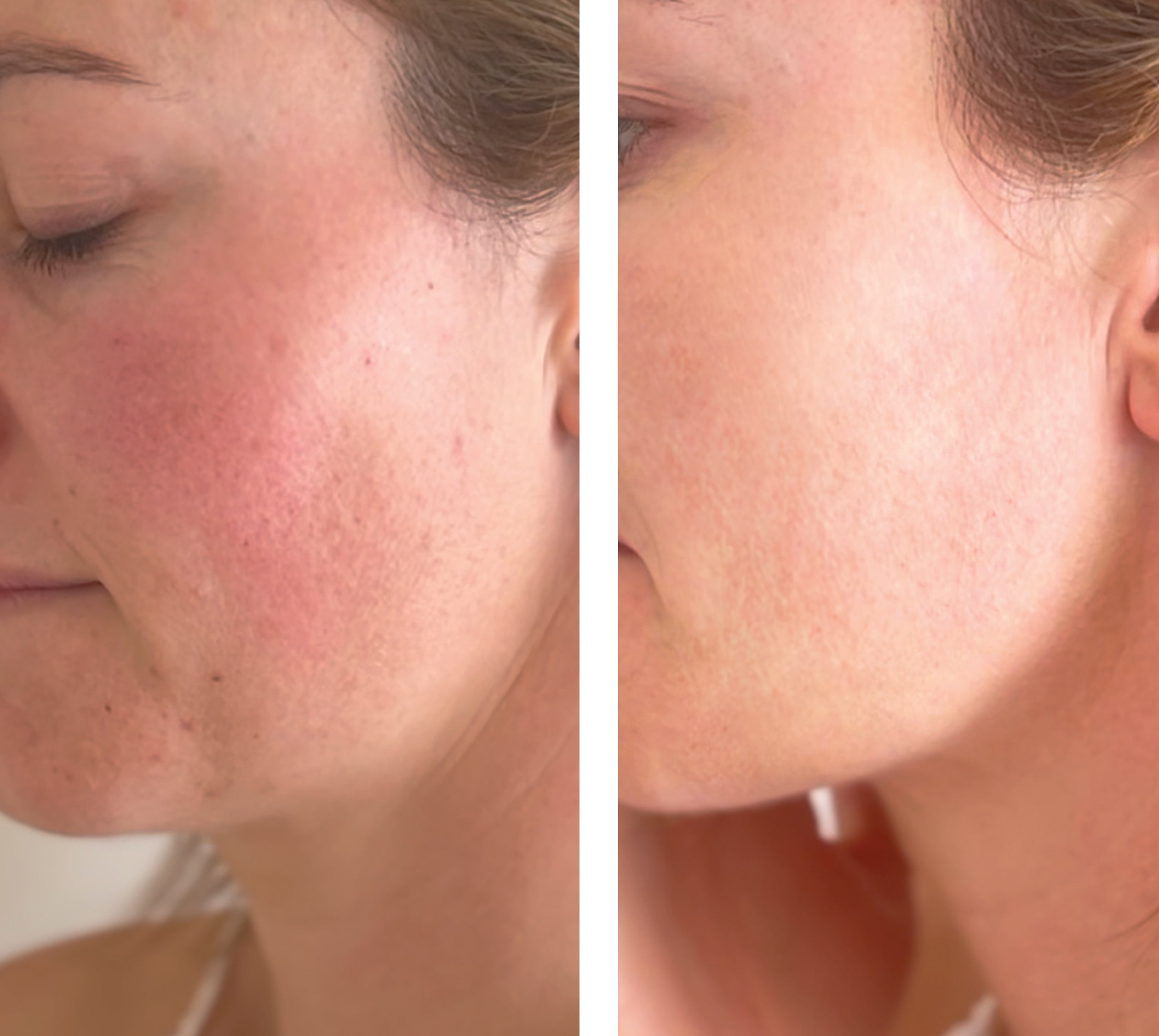 ReShield SPF20 Tinted – Reflect. Protect. Replenish. Repair. Rebuild ...